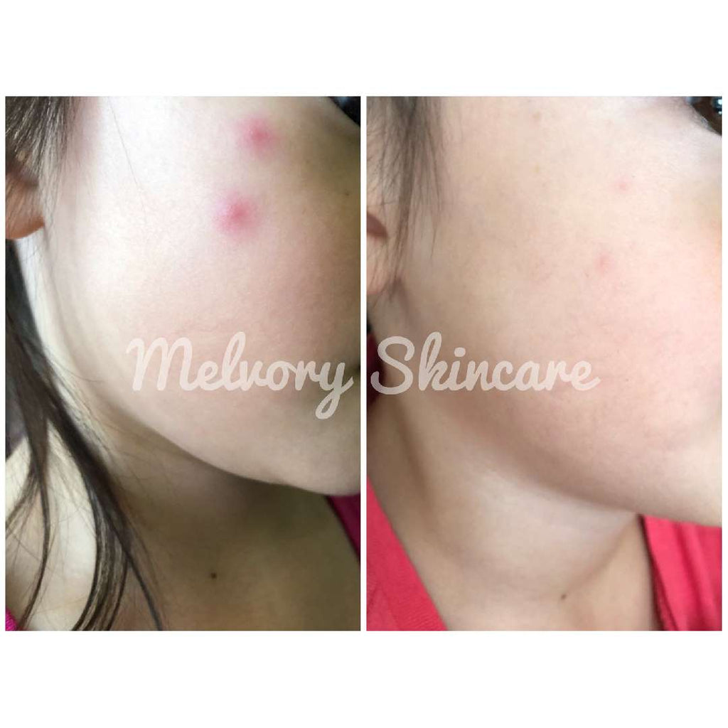 Melvory Skincare: Naturally Healthy Skin — B Eco Family